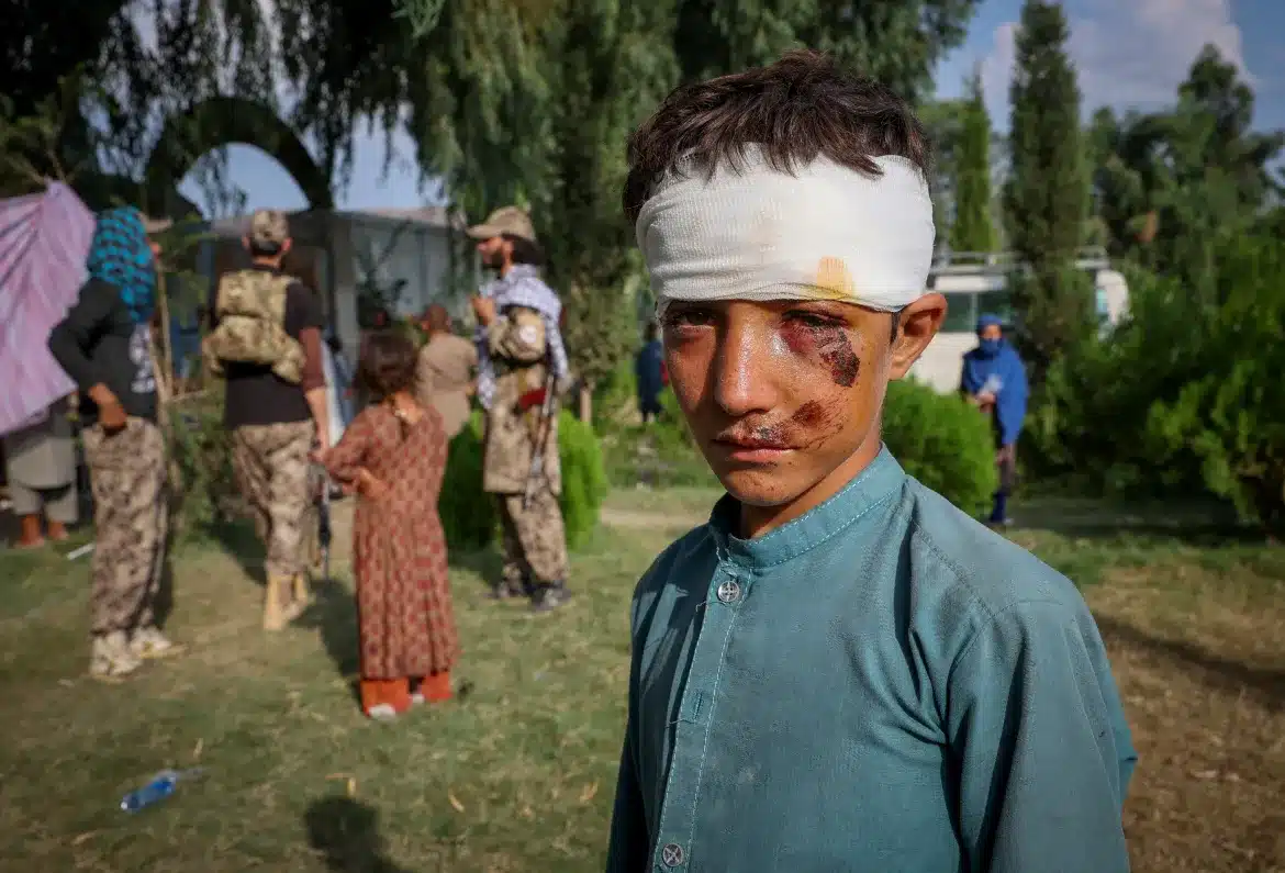 Survivors Seek Refuge in Fields Amid Rising Death Toll - Observer Voice