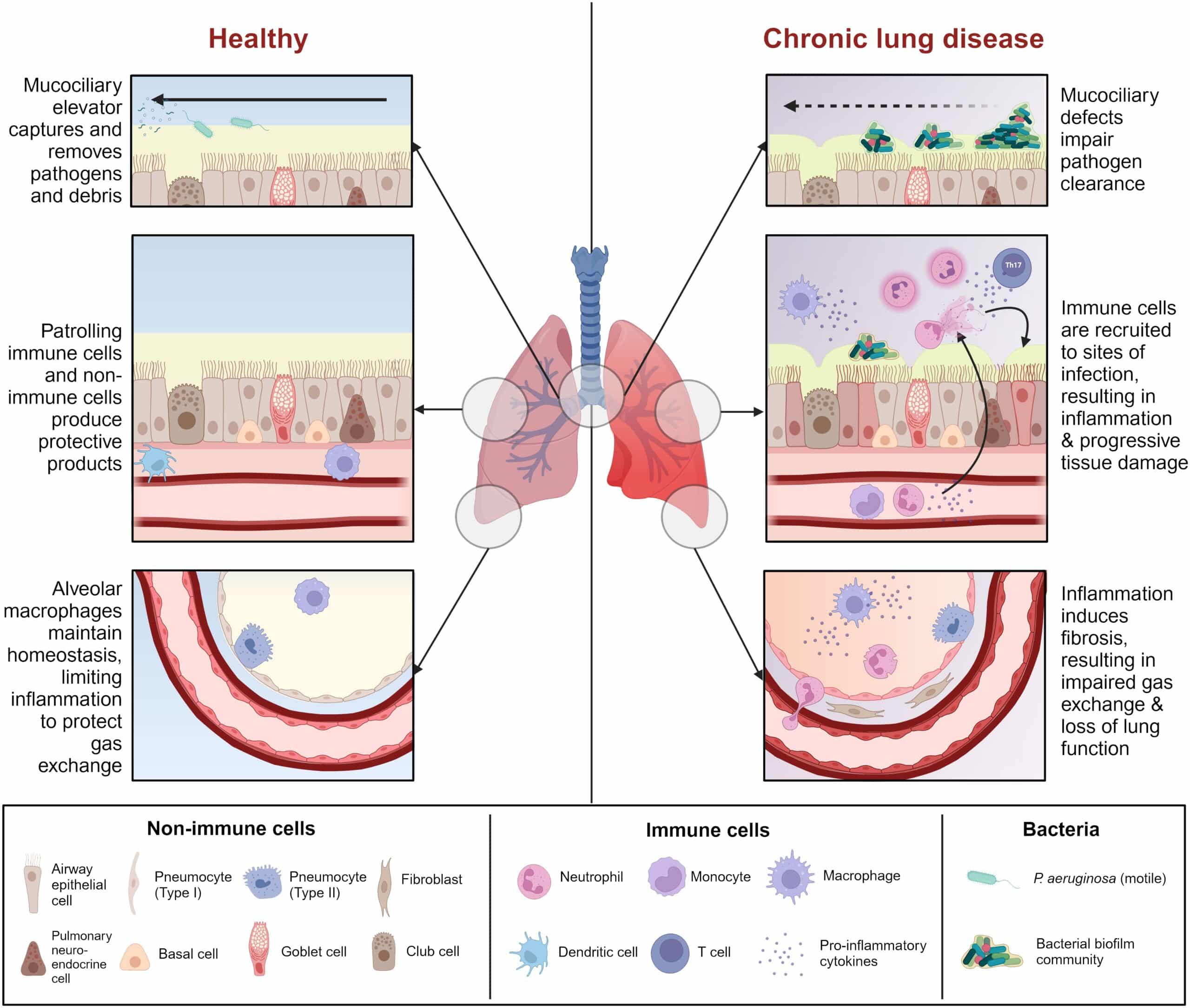 Chronic respiratory diseases: The silent epidemic stealing breath from ...