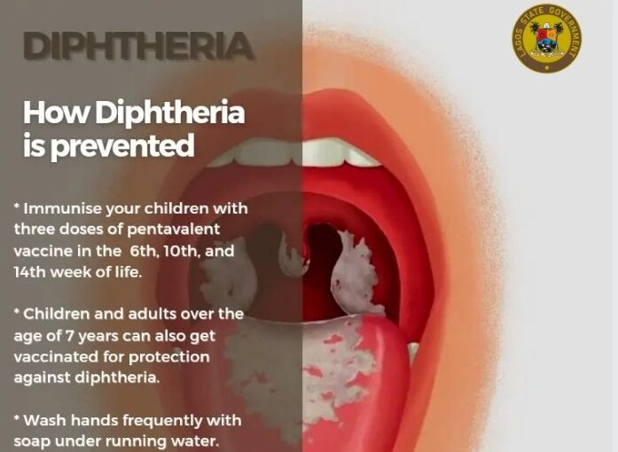 Diphtheria: The throat-coating killer we thought we'd defeated is ...
