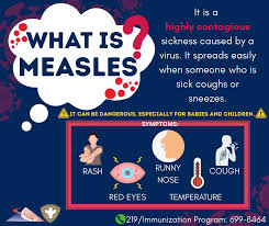 Measles: The Highly Contagious Disease We Can Prevent - Observer Voice
