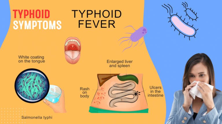 Typhoid Fever: WHO Reports 11-20M Cases as Resistance Spreads ...