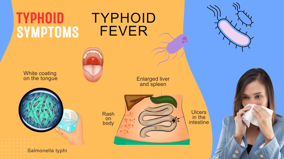 Typhoid Fever: WHO Reports 11-20M Cases as Resistance Spreads ...