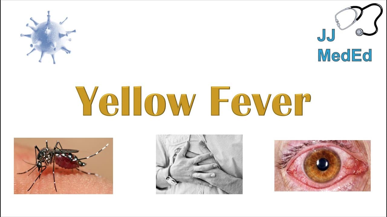 Yellow Fever: WHO Reports 200,000 Cases and 30,000 Deaths Annually ...