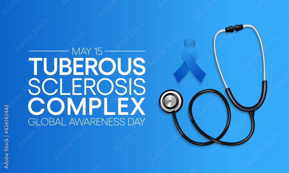 Tuberous Sclerosis Complex: The Genetic Condition Behind Benign Tumors ...